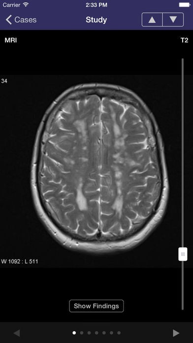 Radiopaedia | iPhone・Android対応のスマホアプリ探すなら.Apps